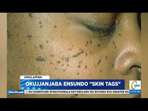 Buubuno obujjanjabi bw'ensundo entono n'ennene #Twejjanjabe - YouTube