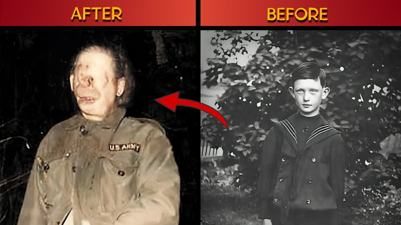 A Man without face | Tragic True Story of Raymond Robinson - YouTube