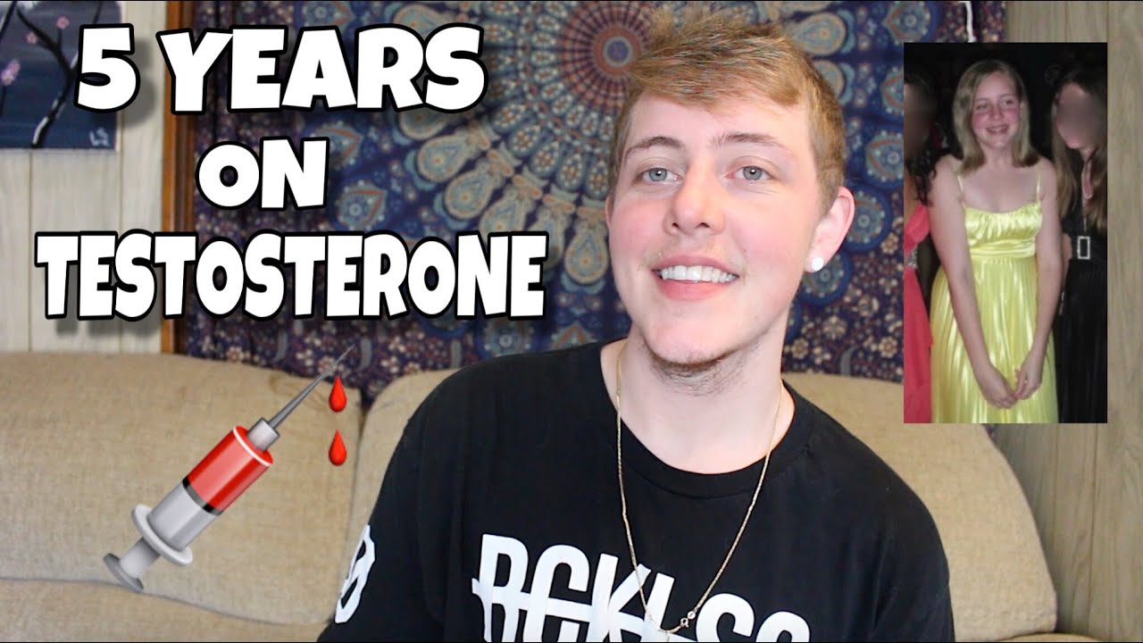 FTM: 5 YEARS ON TESTOSTERONE TIMELINE COMPARISON - YouTube