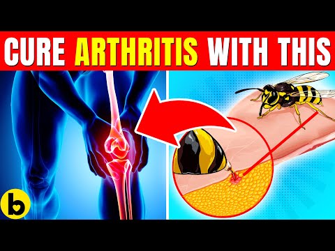 How Many Joints Do Bees Have In Their Arms