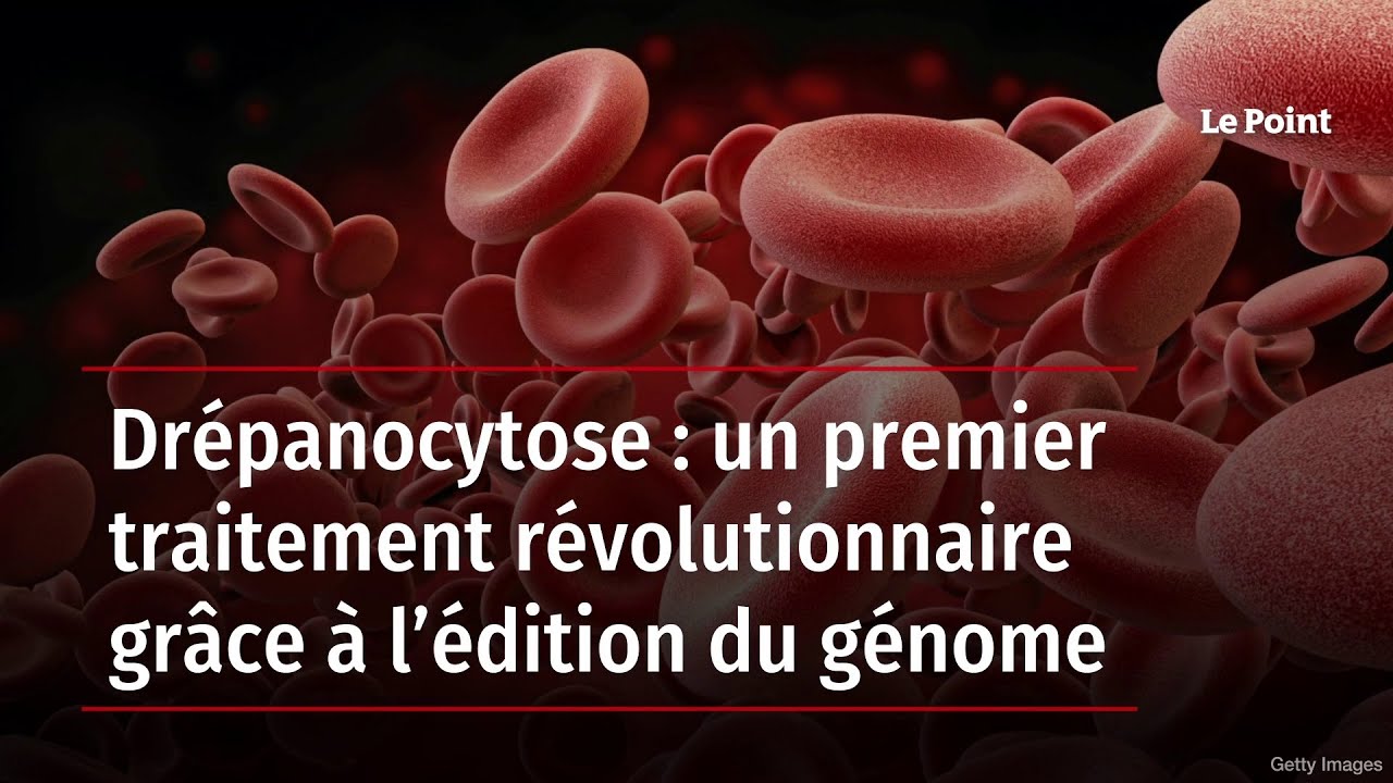 Drépanocytose : un premier traitement révolutionnaire grâce à l’édition ...