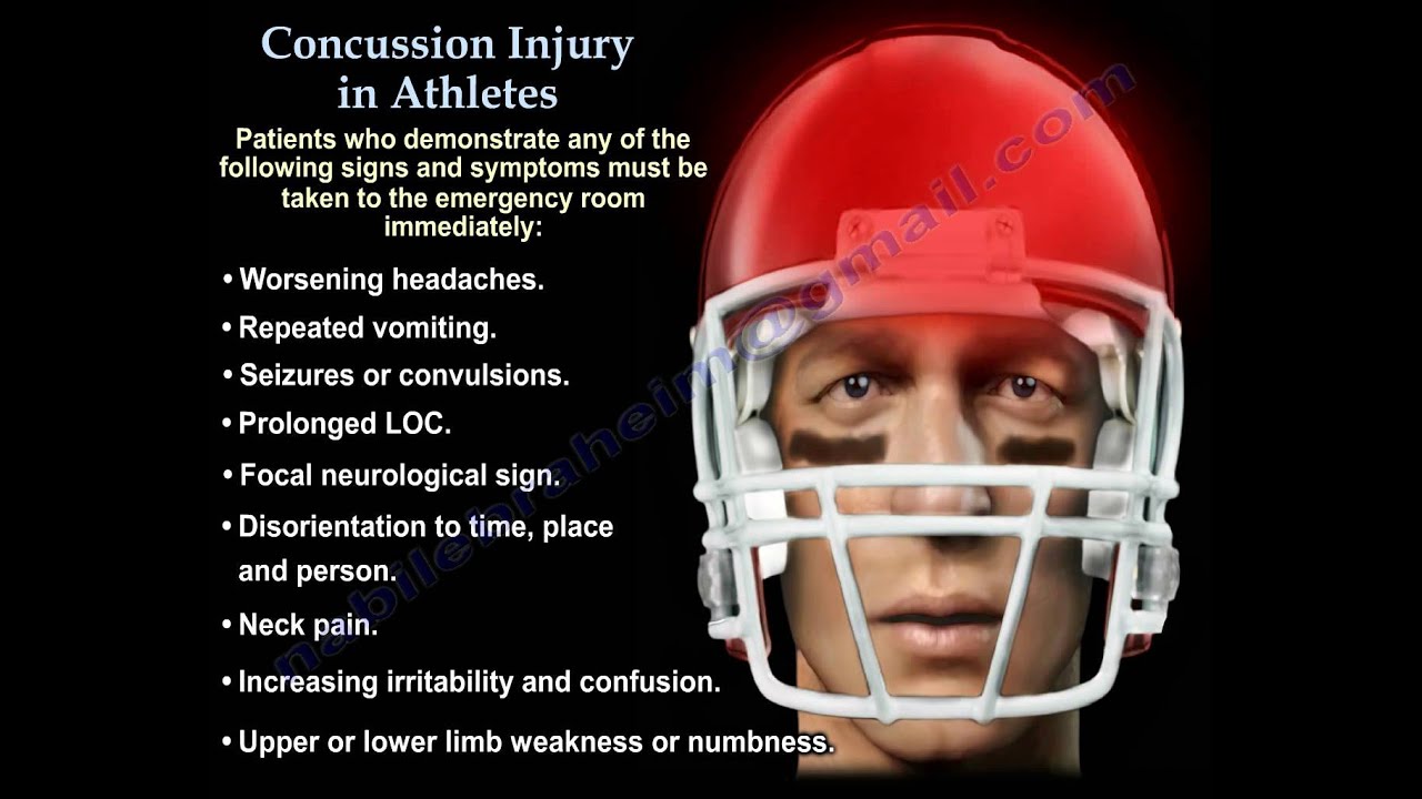 Concussion In Athletes - Everything You Need To Know - Dr. Nabil ...
