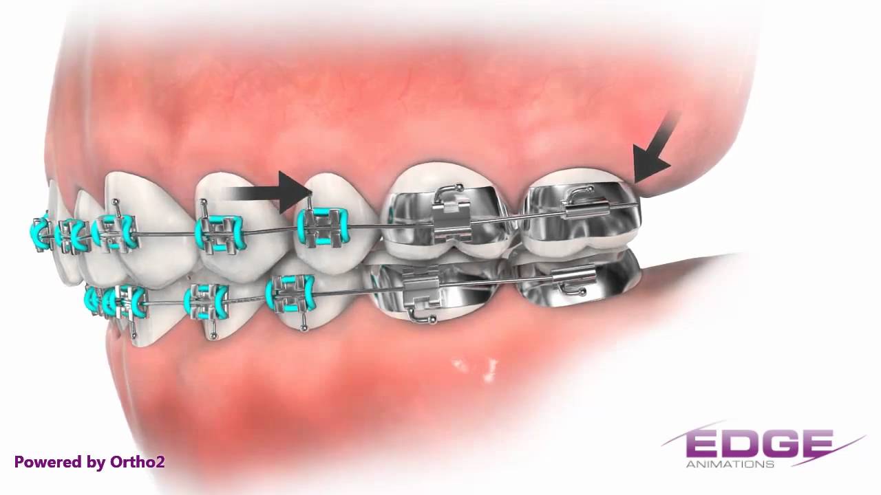 Edge Animations Pokey Wire Demo - YouTube