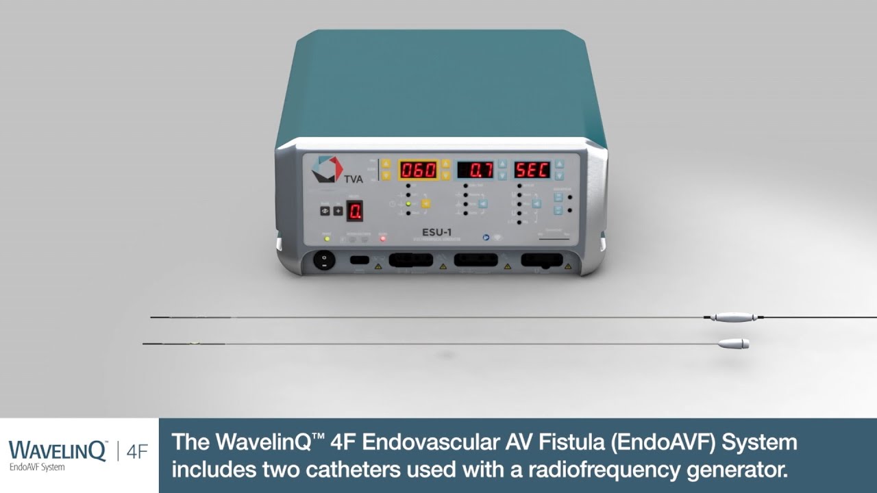 WavelinQ™ 4F EndoAVF System Procedural Animation OUS - YouTube