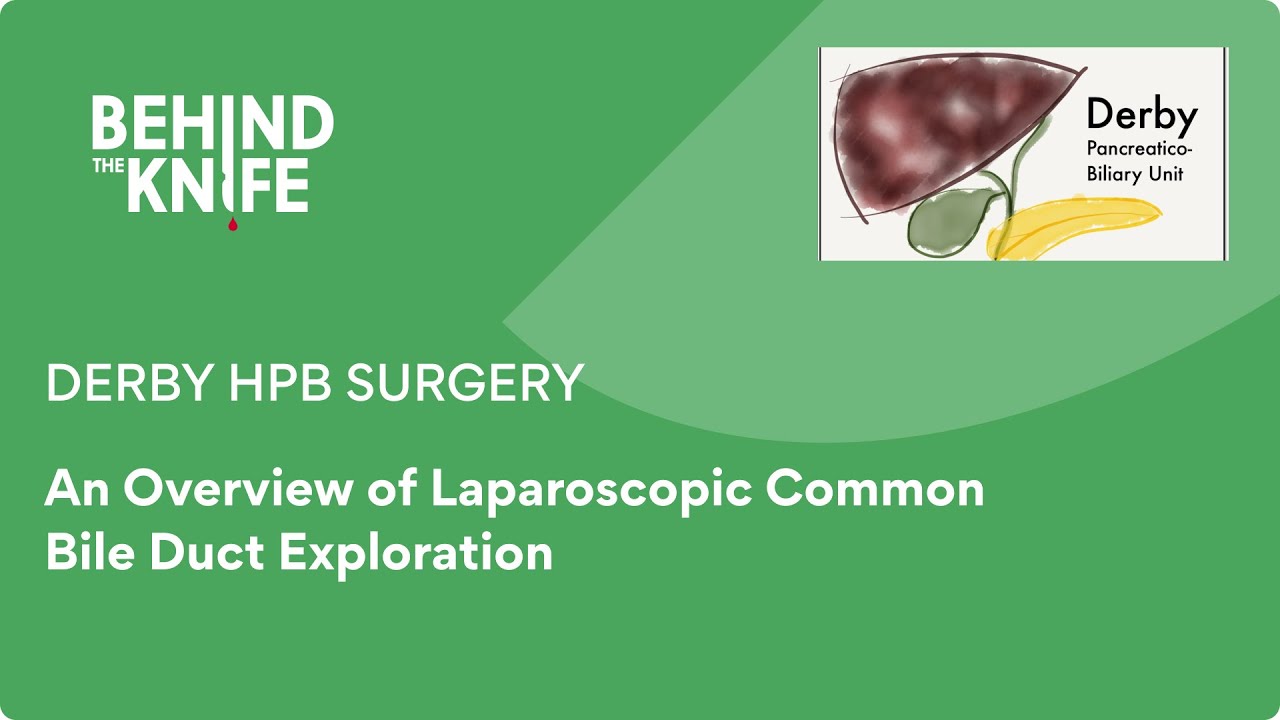 Derby HPB Surgery: An Overview of Laparoscopic Common Bile Duct ...