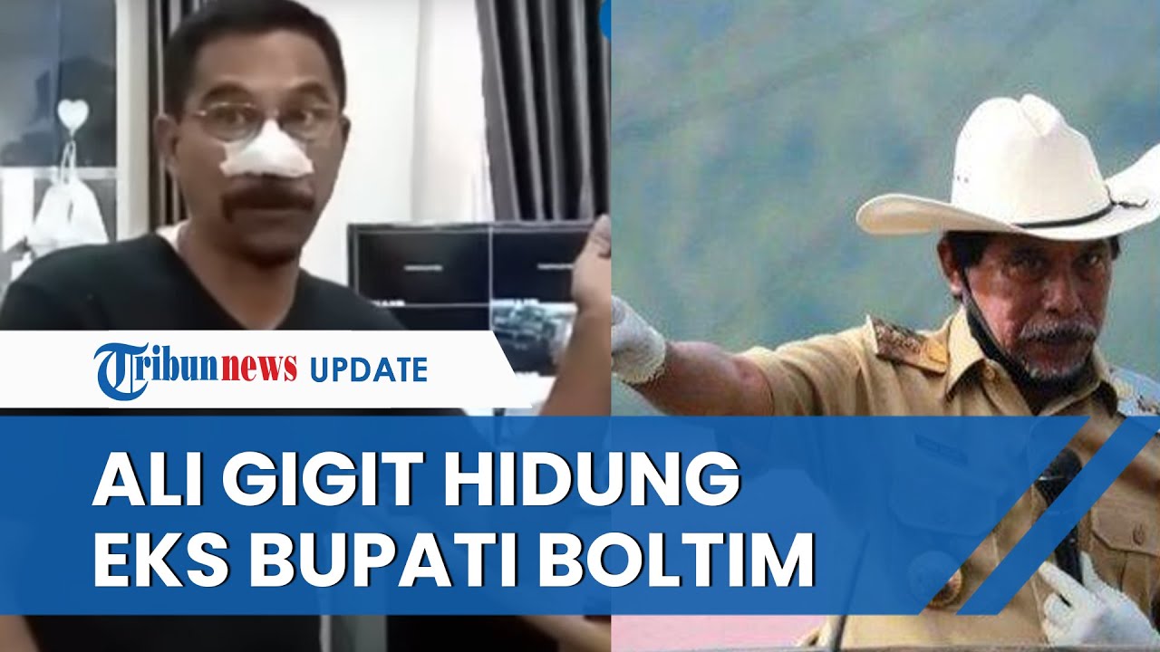 Sosok Ali Kenter yang Gigit Hidung Mantan Bupati Boltim Sehan hingga ...