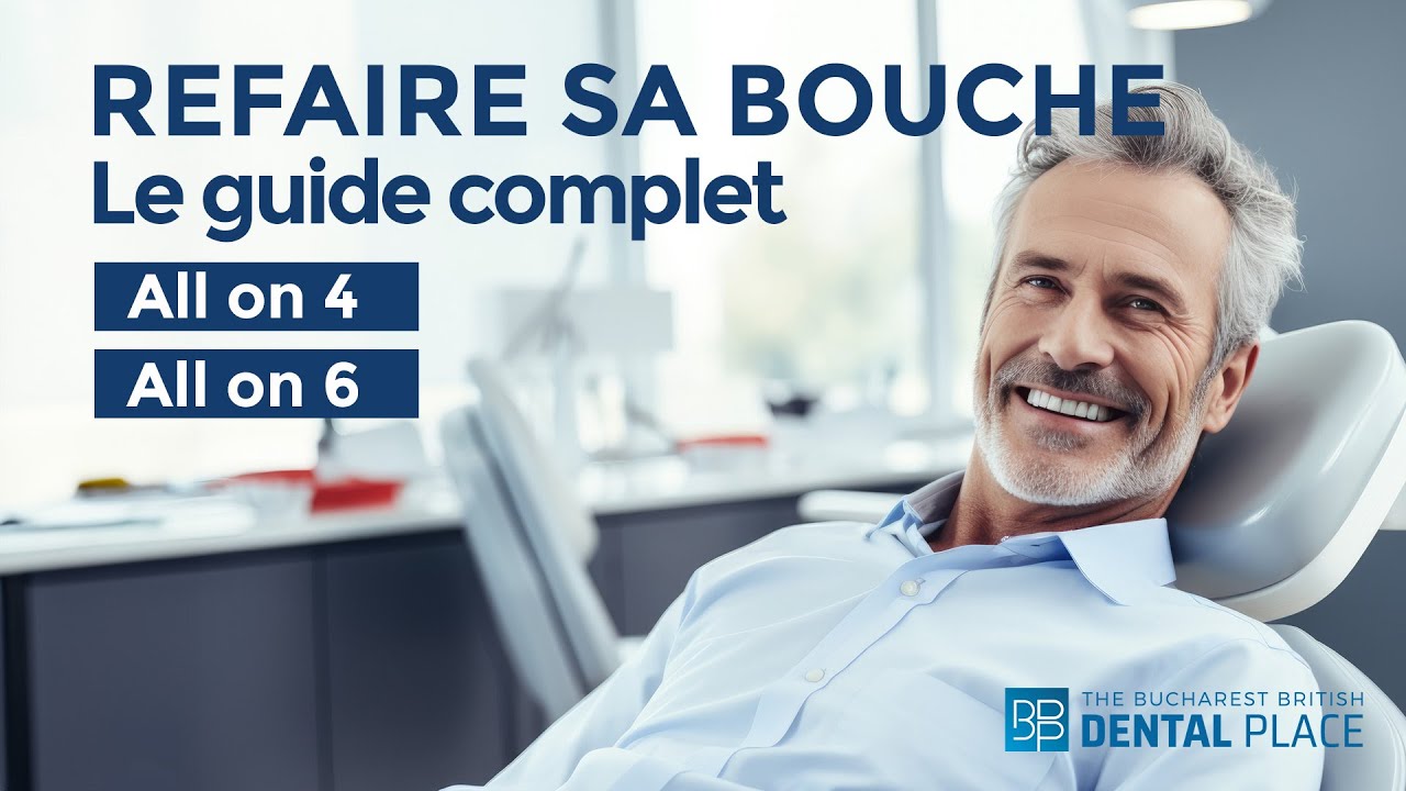 Refaire sa bouche, All on 4 et 6, Bridge Malo - Le guide complet - YouTube