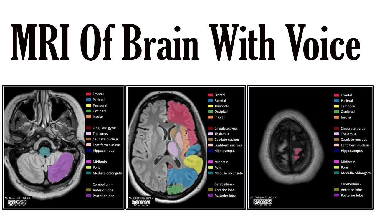 MRI of brain with voice study - YouTube