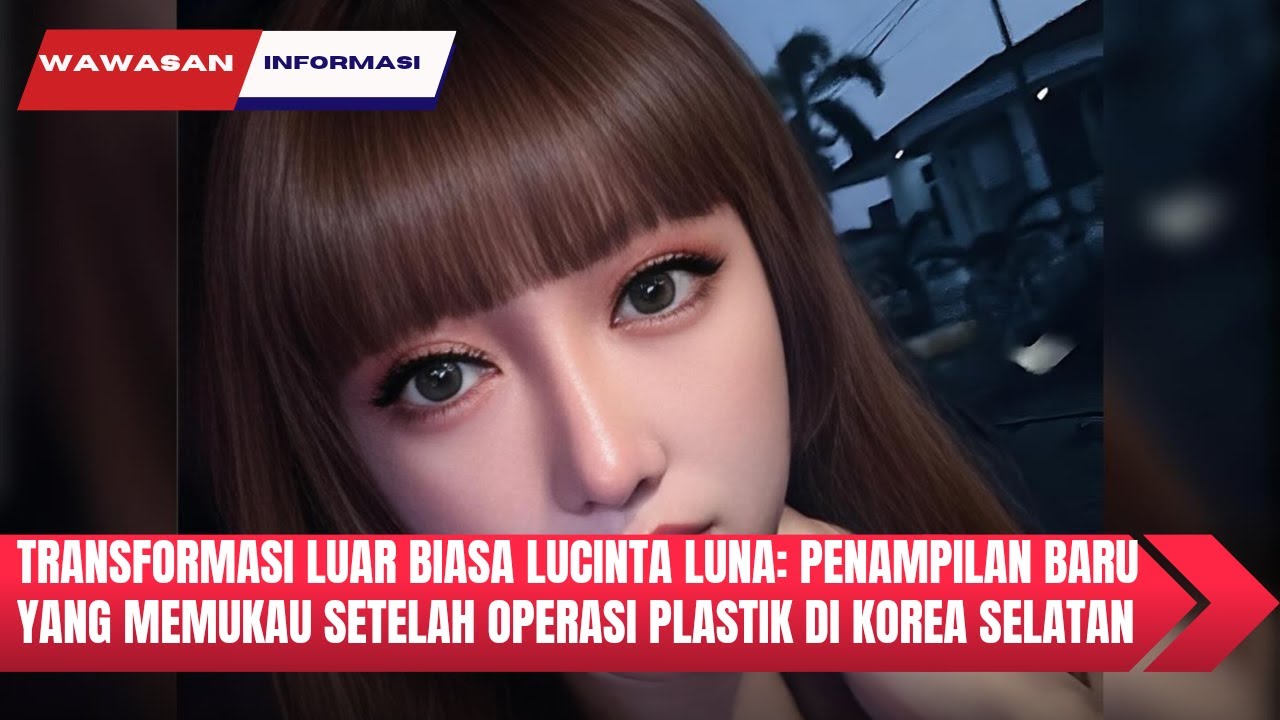 Lucinta Luna: Penampilan Baru yang Memukau Setelah Operasi Plastik di ...