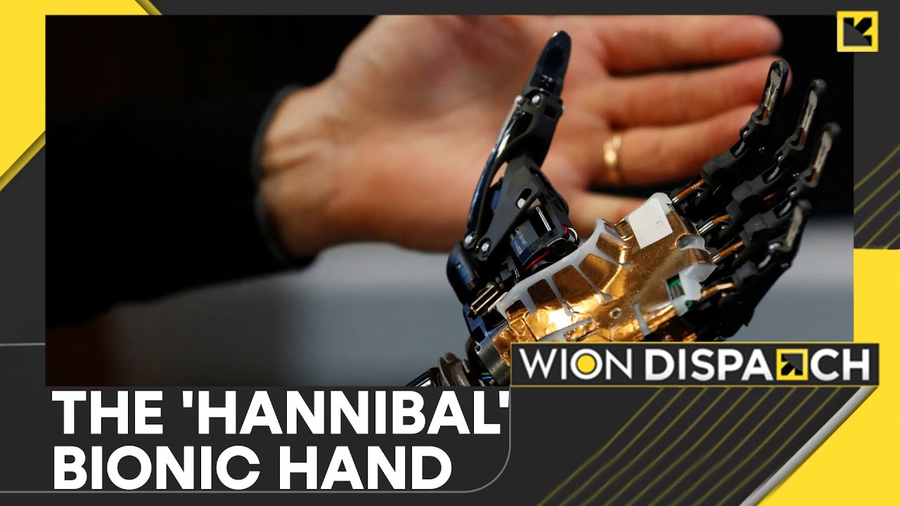 AI Bionic Limb, Ready To Be Used In Just One Week | New Era For ...