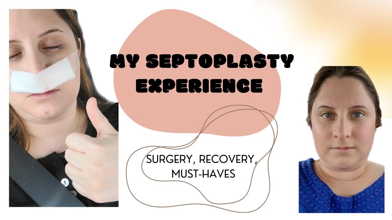 My Septoplasty & Turbinate Reduction Experience ⏐ Surgery, Recovery ...