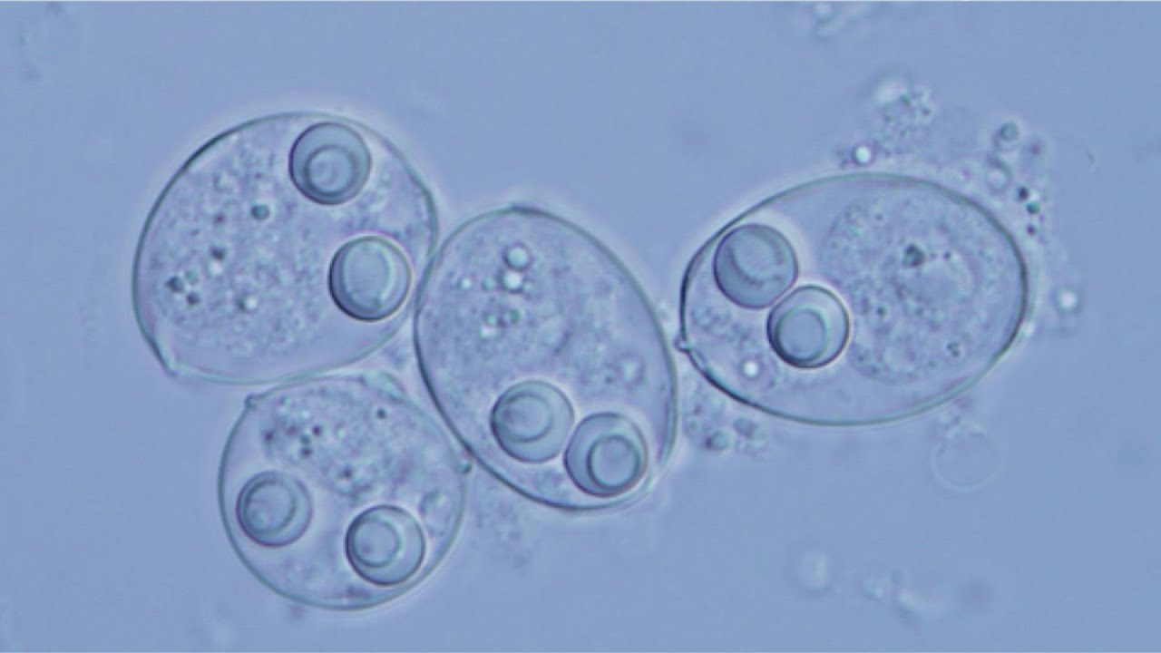 Filo Cnidaria – Parte 7: Myxozoa e Polypodiozoa. - YouTube