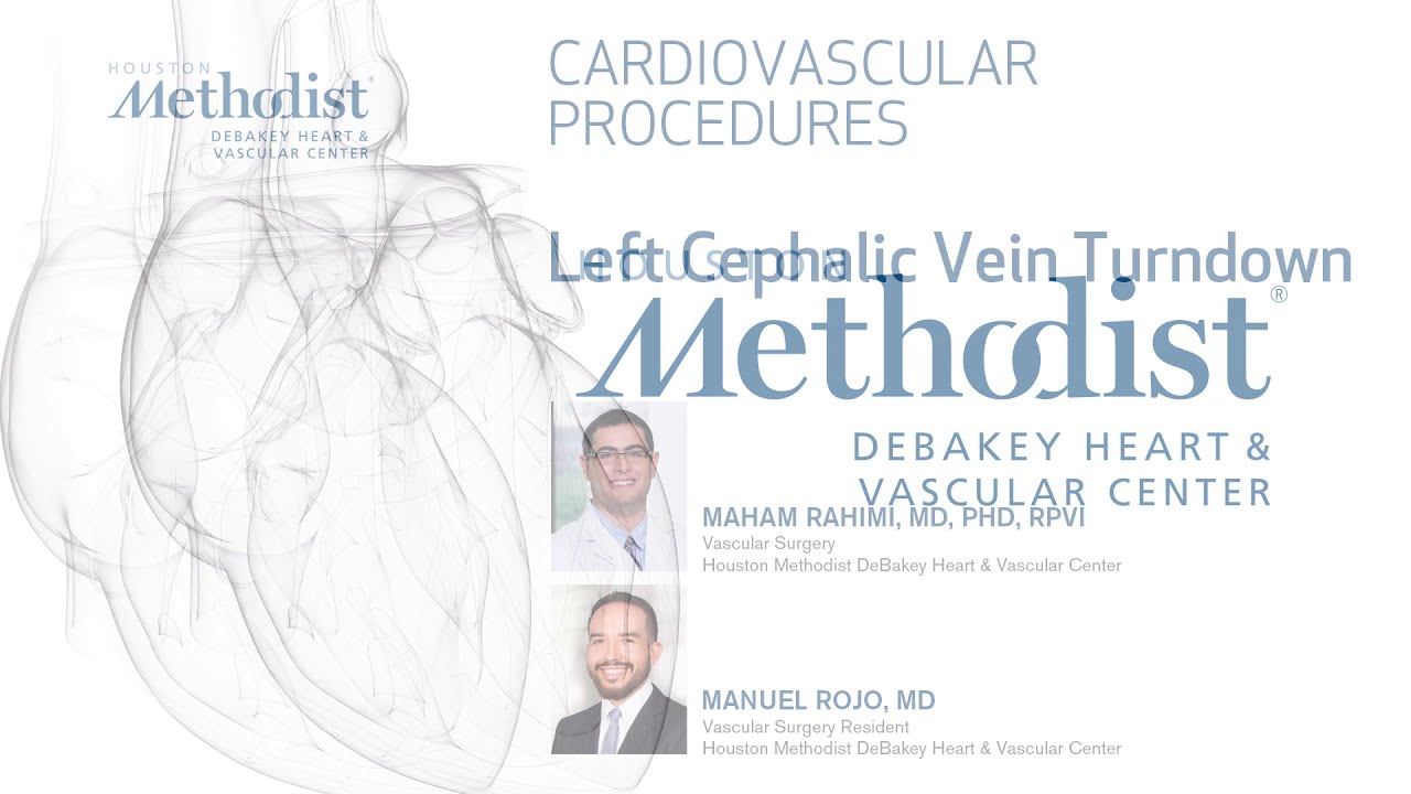 Left Cephalic Vein Turndown (Maham Rahimi, MD, PhD and Manuel Rojo, MD ...