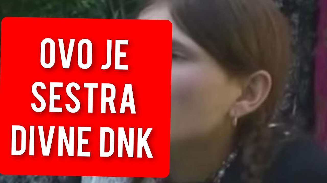 OPERACIJA KICME ZA DIVNU DNK - POGLEDAJTE KAKO IZGLEDA SESTRA DIVNE DNK - YouTube