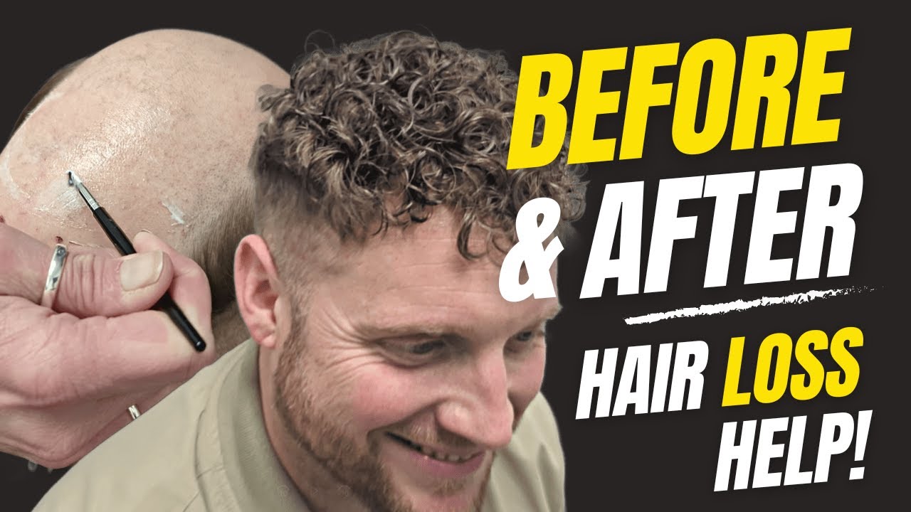 BEFORE & AFTER! PERMED HAIR SYSTEM (CURLS/WAVY)! FITTING DAY! - YouTube