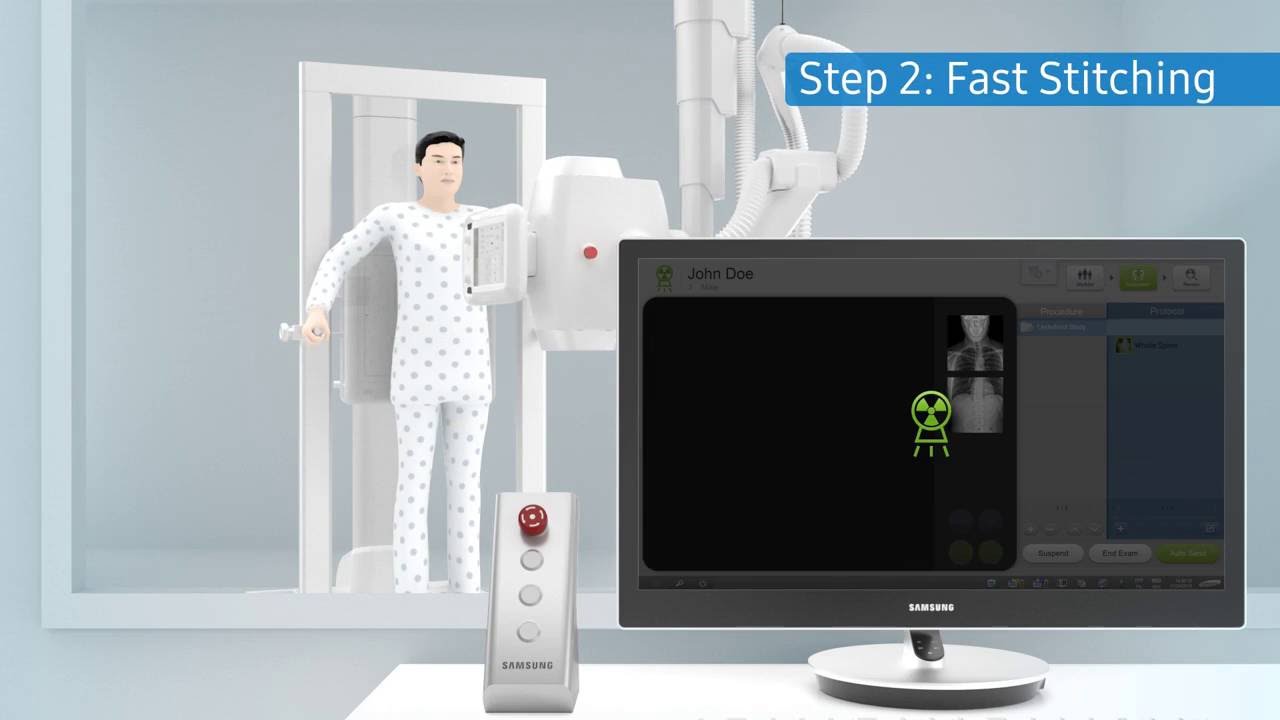 NEW Smart Innovations: Fast Stitching for GC85 Smart DR - YouTube