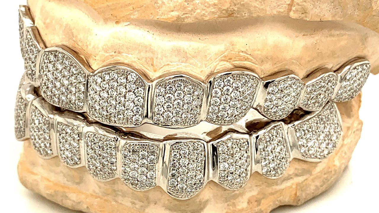 Diamond Grillz, Honeycomb Grillz by Seattle Gold Grillz. - YouTube