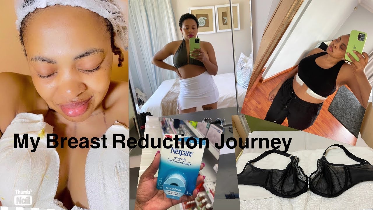 My Breast Reduction Journey Youtube