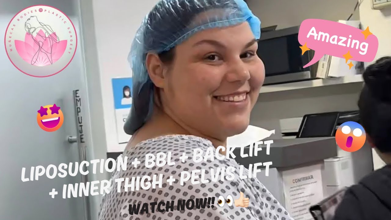 Liposuction + BBL + Back Lift + Inner Thigh + Pelvis Lift # ...