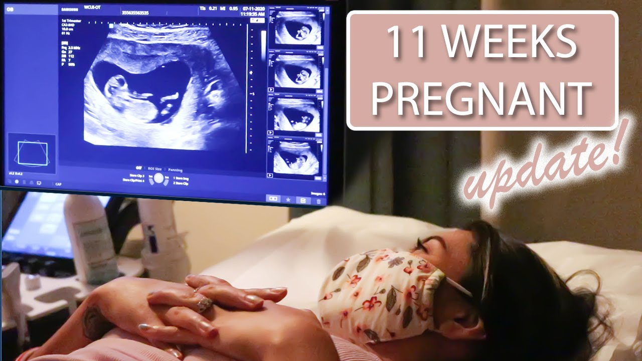 BABY ULTRASOUND - 11 WEEKS - YouTube