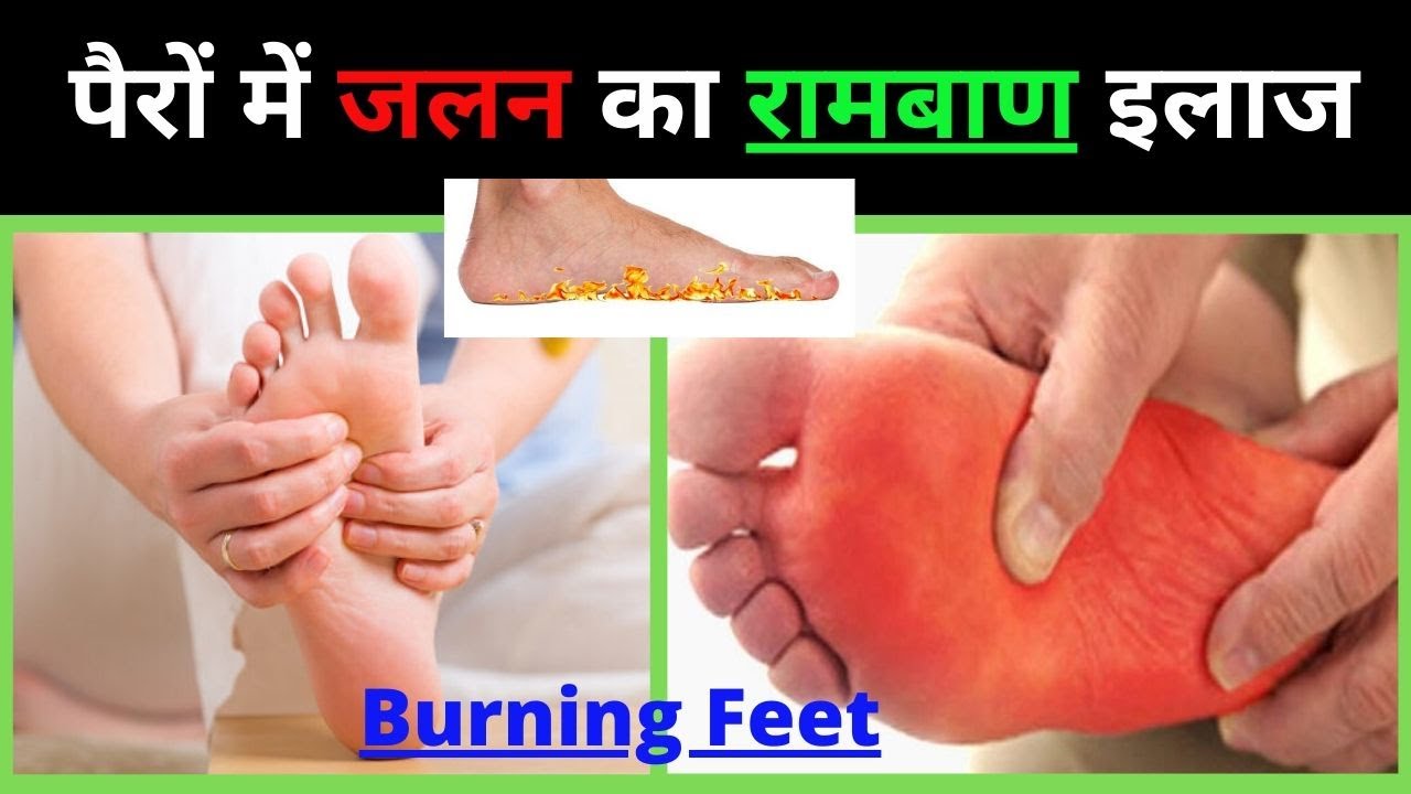 Pairo ke Talvo me jalan ka Ramban Ilaj|पैरों के तलवो में जलन का रामबाण ...