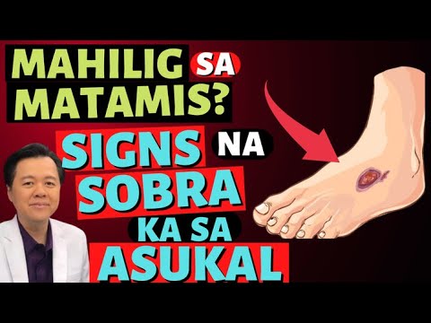 Mahilig sa Matamis? Signs Na Sobra Ka sa Asukal. - By Doc Willie Ong ...
