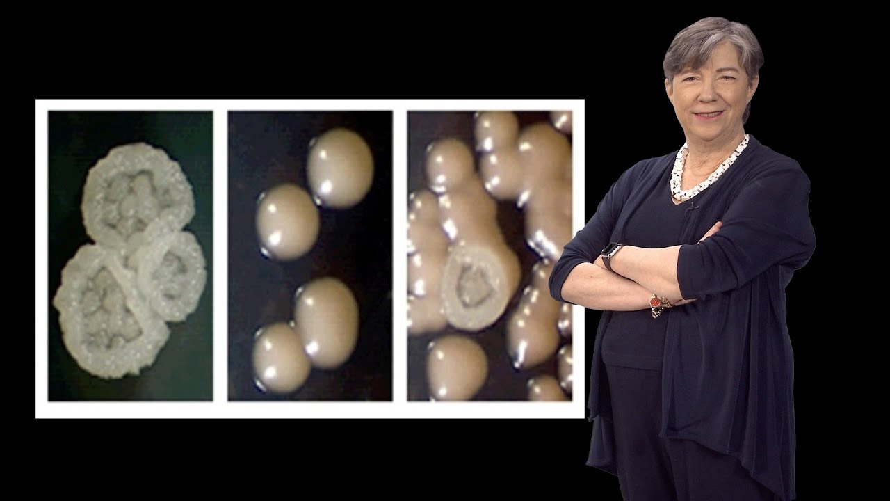 Susan Lindquist (Whitehead, MIT / HHMI) 3: Prions: Protein Elements of ...