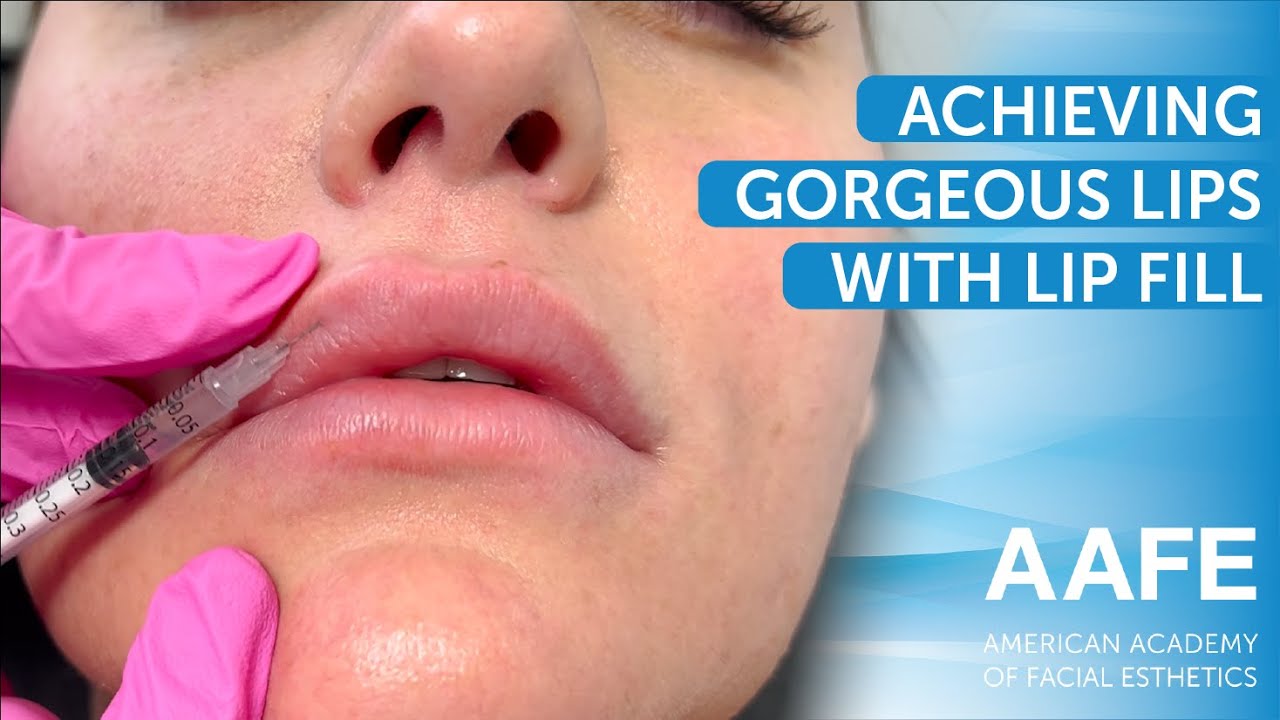 Achieving Gorgeous Lips with Lip Filler - YouTube