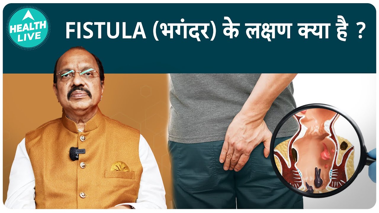 Common Symptoms of Fistula Explained In Hindi | Treatment of Fistula ...