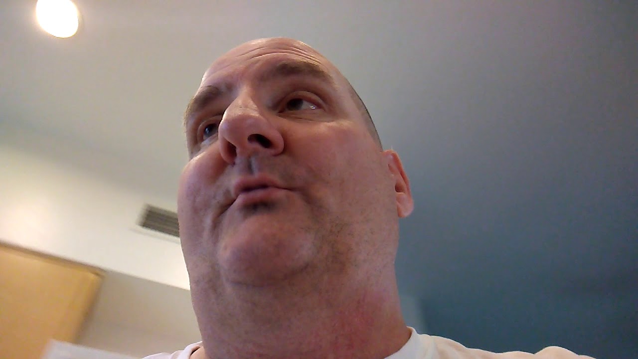 SOACAM SUGAR 347 TAMI'S TOE-ECTOMY - YouTube