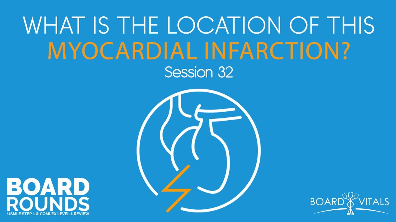 32: What Is the Location of this Myocardial Infarction? - YouTube