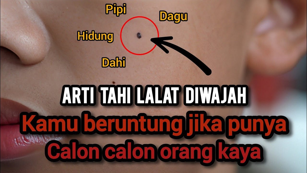 KAMU ORANG BERUNTUNG JIKA ADA !! 5 ARTI TAHI LALAT DIWAJAH PIPI, KENING ...