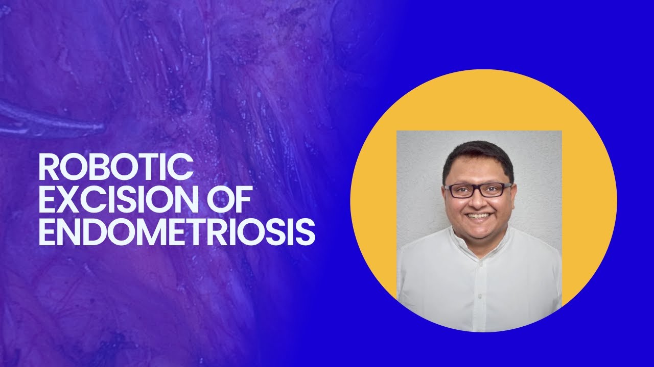 Robotic Excision of Posterior compartment endometriosis (With Voiceover ...