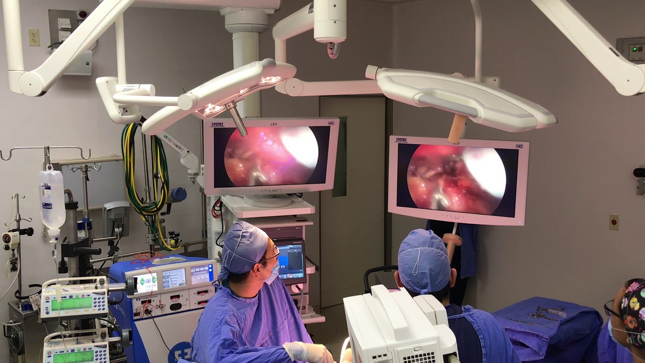 Plastia inguinal total extraperitoneal - YouTube