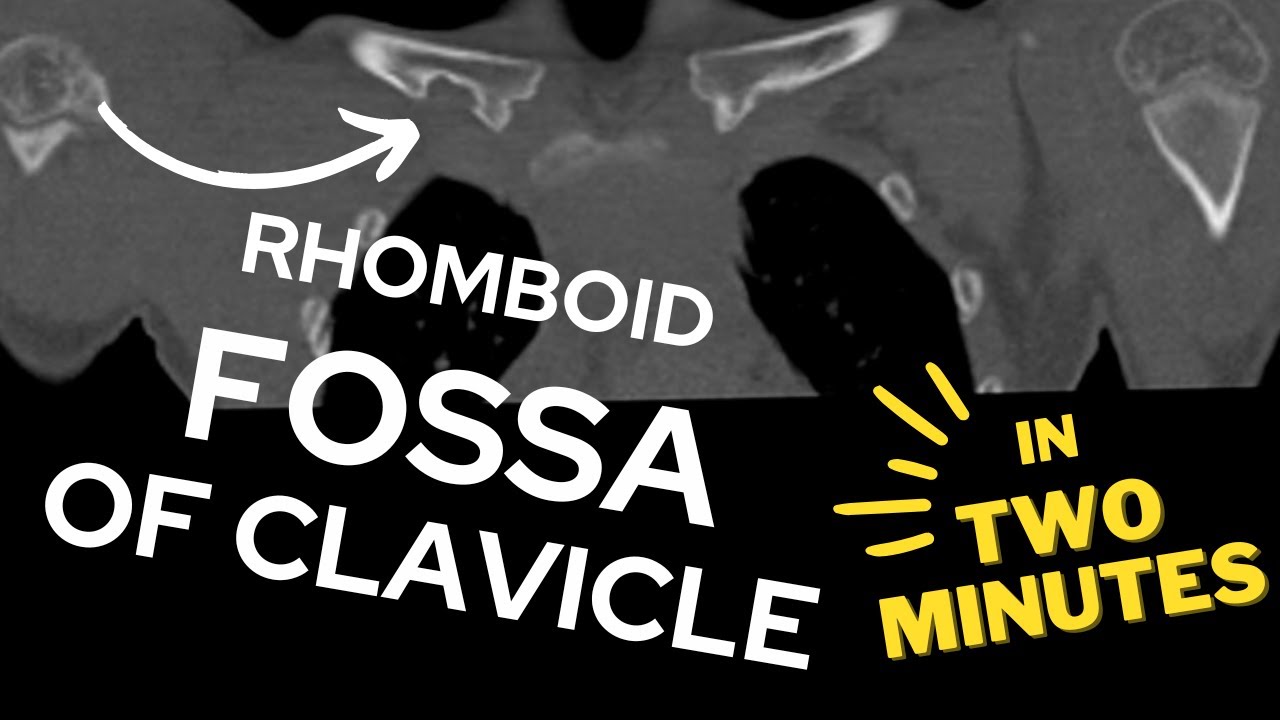 Rhomboid fossa (Clavicle) - in TWO MINUTES - YouTube