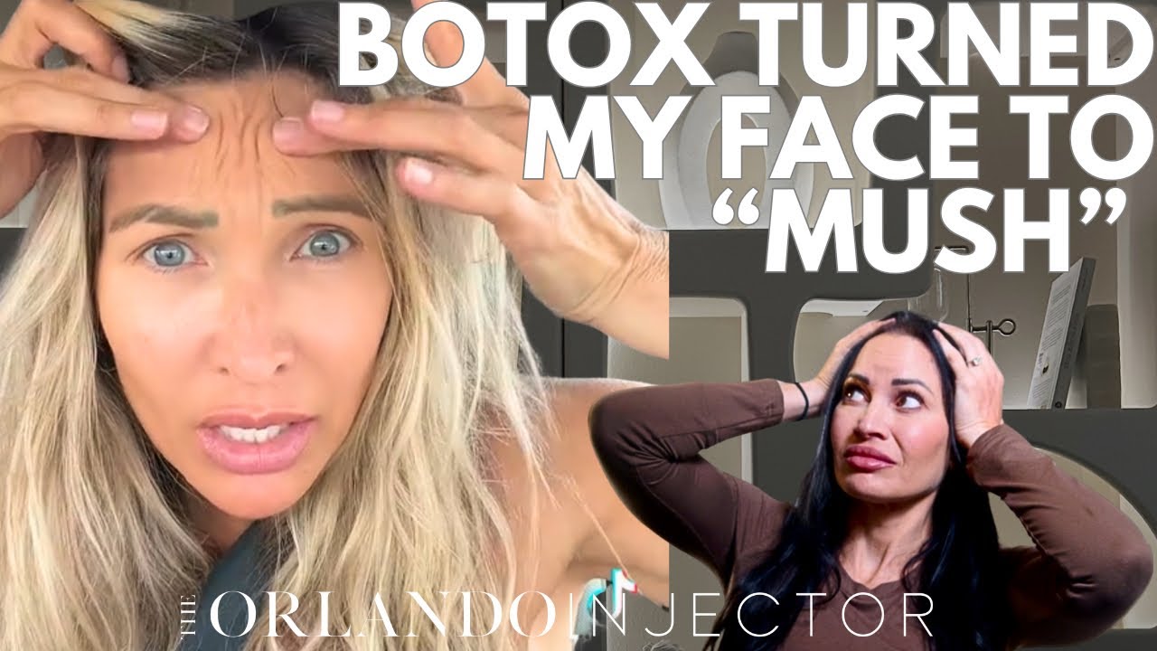 BOTOX TURNED MY FACE TO “MUSH” - YouTube