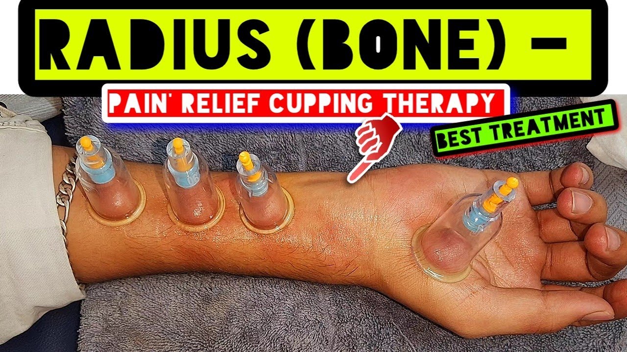 Radius (bone) - PAIN' Relief Cupping therapy || Bone pain treatment ...