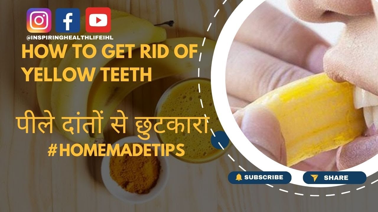 How to Get Rid of Yellow Teeth - Natural Teeth Whitening Methods # ...