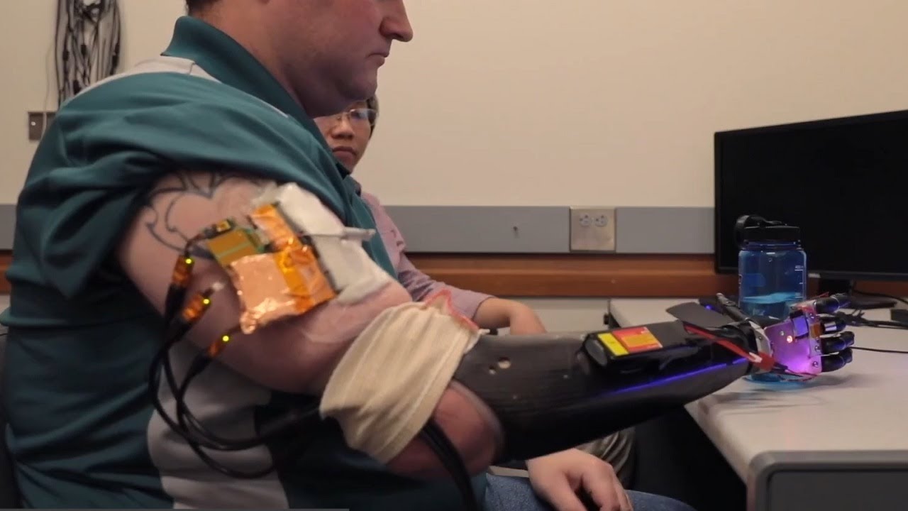 BCI Controlled Robot Arm For Amputee | Breakthrough 3D Printing Tech ...