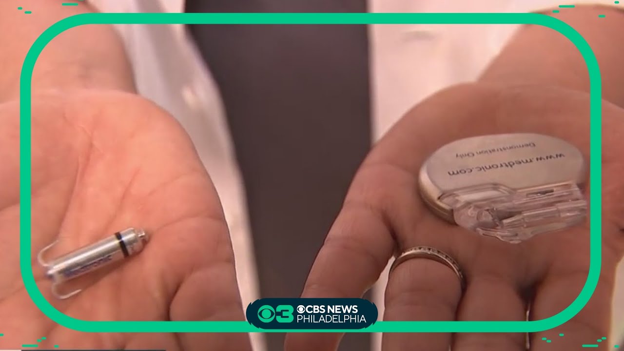 Baby recovering after receiving smallest pacemaker in the world - YouTube