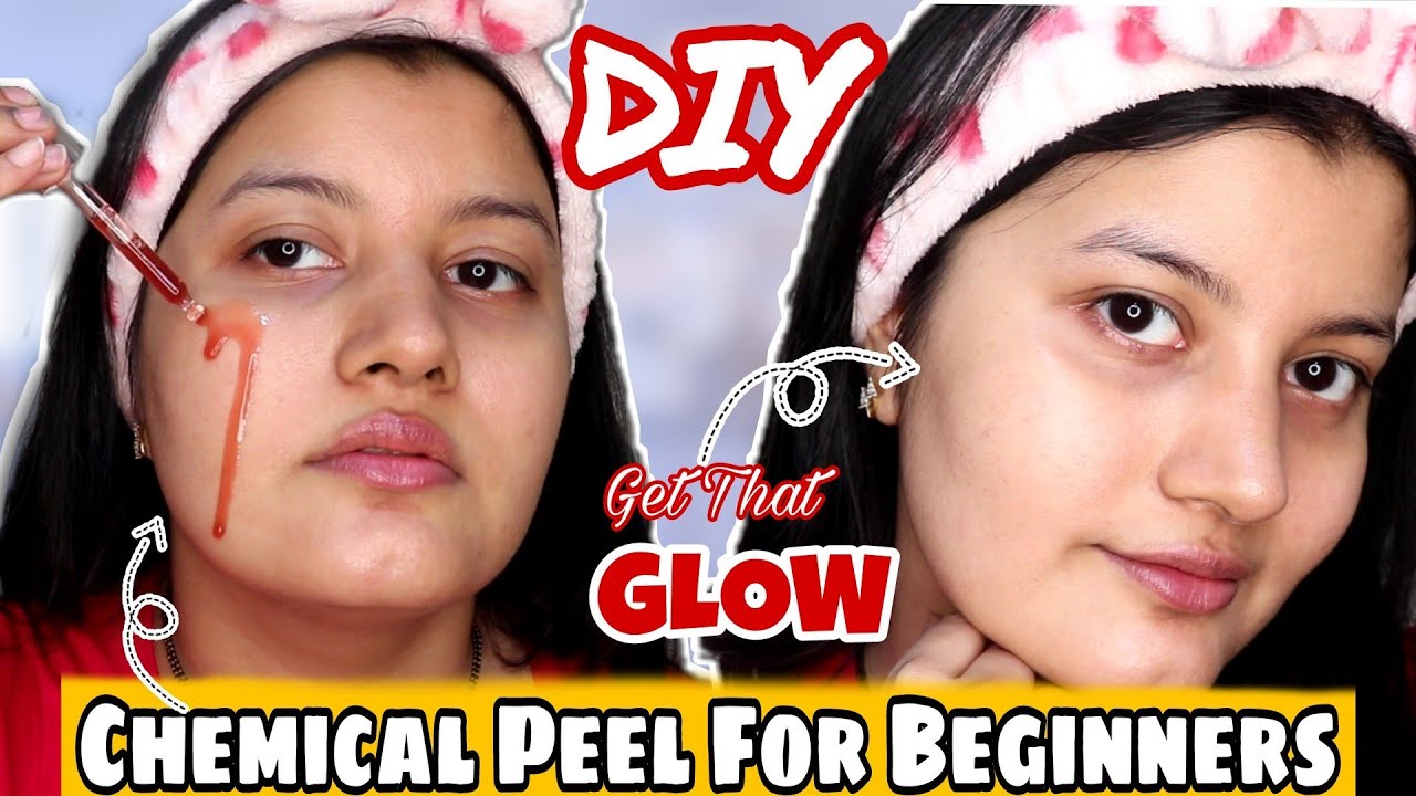 CHEMICAL PEEL - Benefits, Side Effects, Do's and Dont's | Is Chemical ...