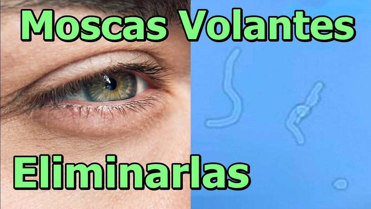 COMBATIR LAS MOSCAS VOLANTES EN LOS OJOS Y TODAS LAS CAUSAS, INCLUIDA ...
