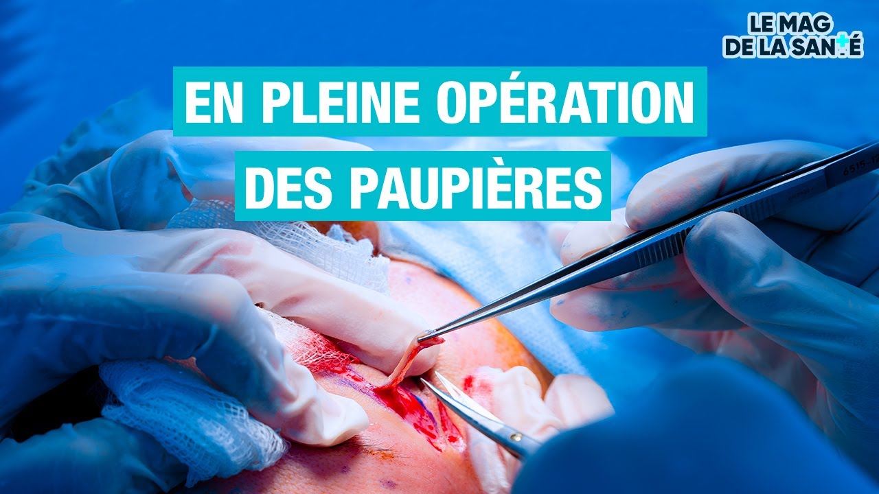👁️ Une chirurgie pour remonter les PAUPIÈRES - Allo Docteurs - YouTube