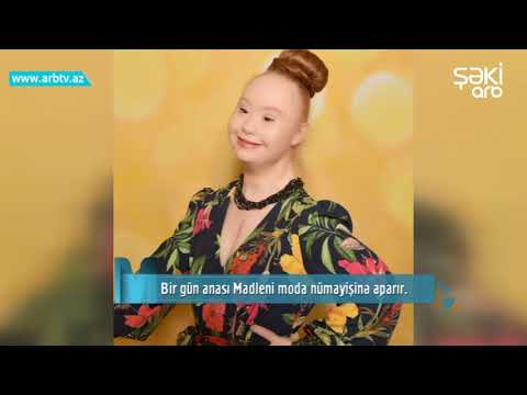 Daun sindromlu model... (MARAQLİDİR 20.08.2019)