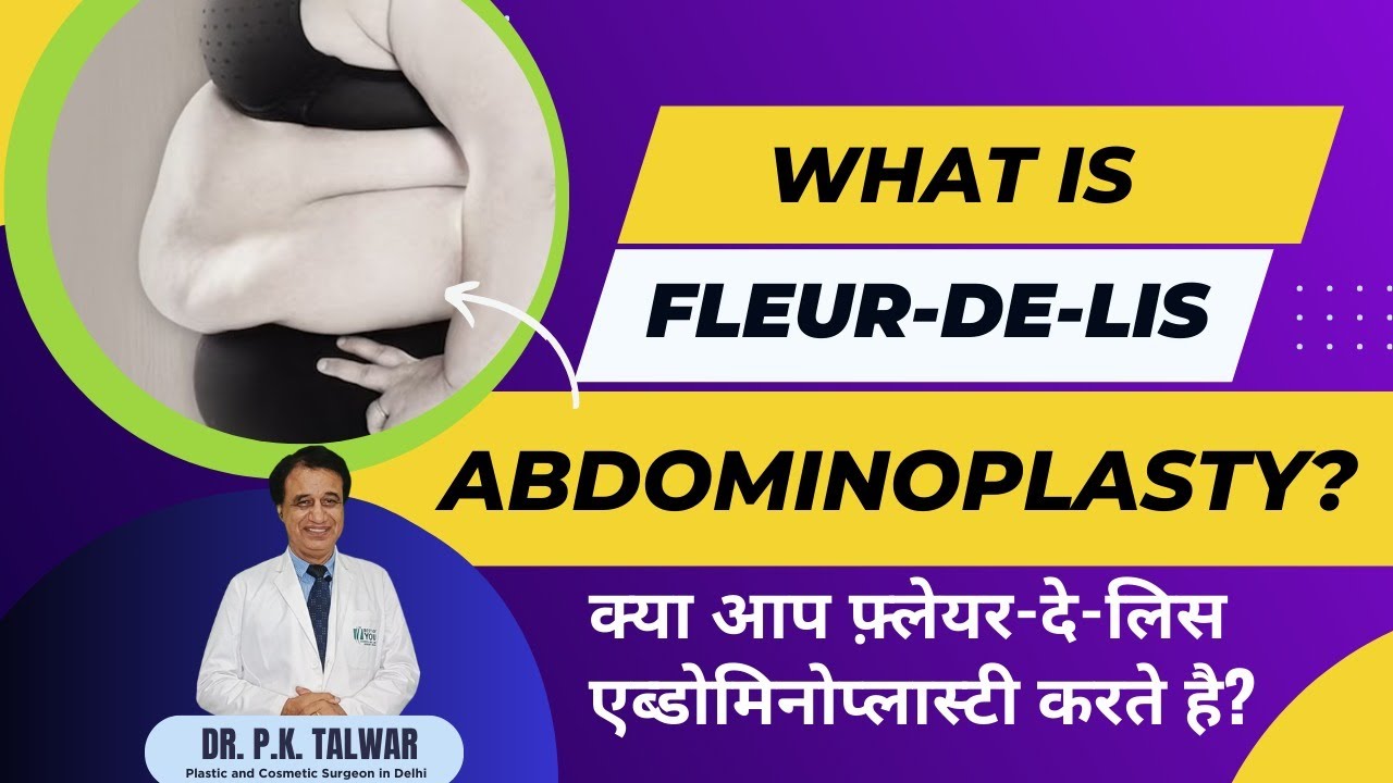 What Is Fleur De Lis Abdominoplasty Tummy Tuck Surgery In Delhi Dr
