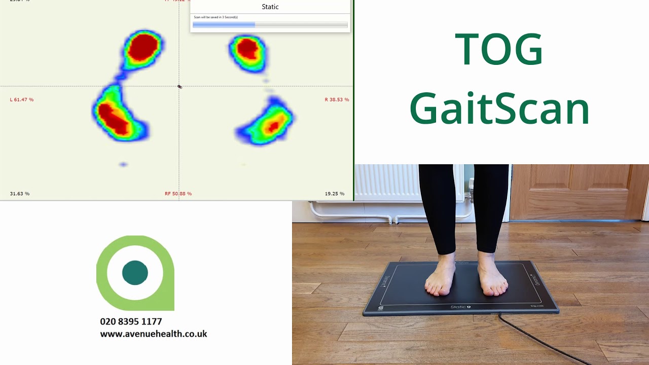How do you do the GaitScan for orthotics at Avenue Health? - YouTube