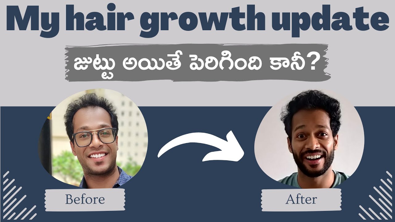My hair growth update | I am doing this everyday to reduce hairfall ...