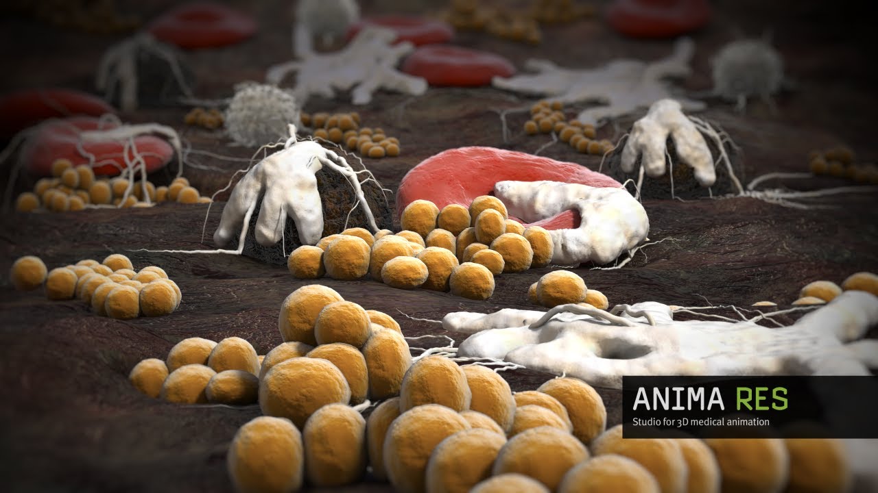 3D Medical Animation - Application of octenilin® Wound Gel & octenilin ...