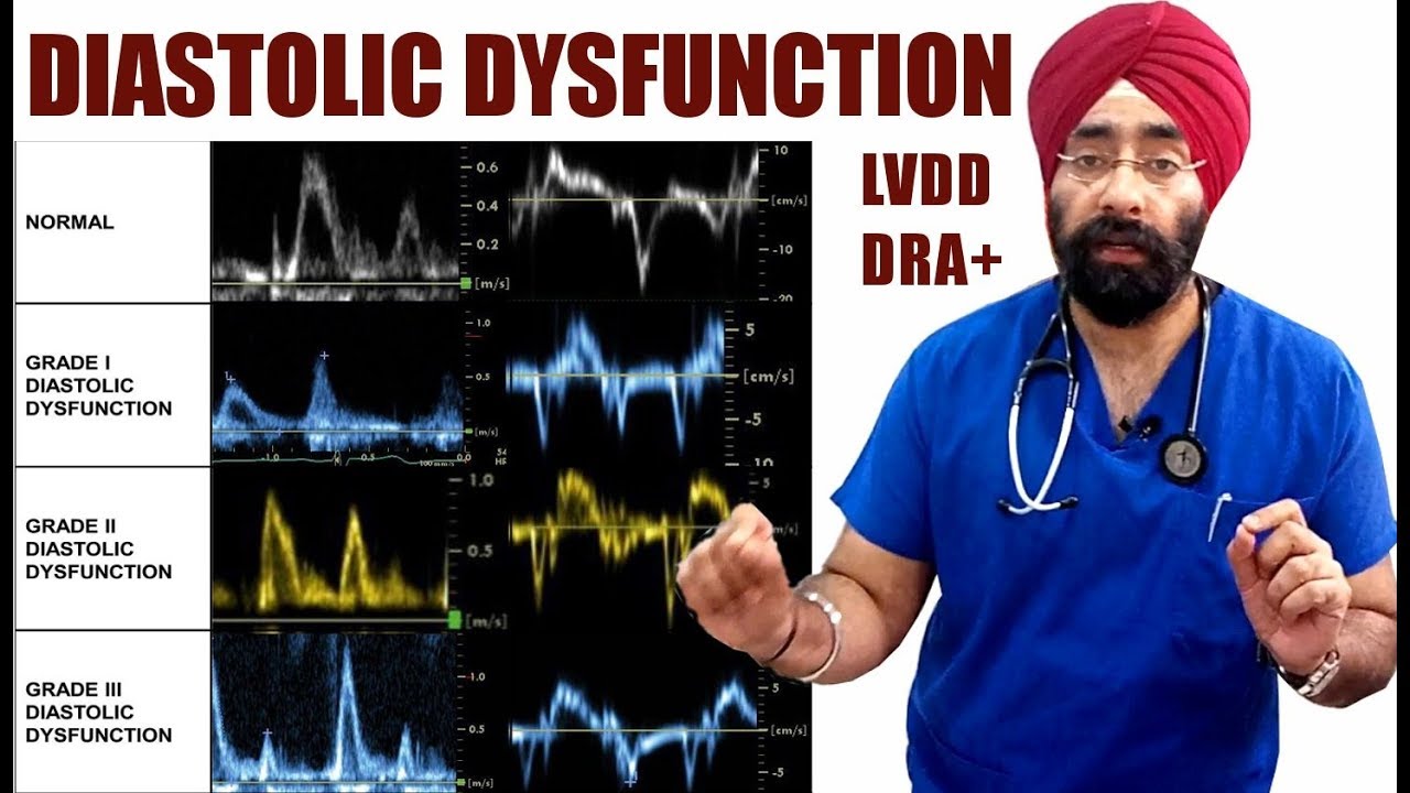 Rx Heart #19 (Eng) Diastolic Dysfunction | LVDD | Diastolic Heart ...