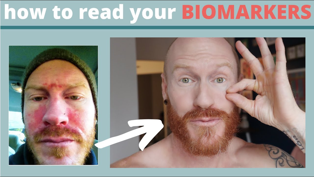 How To Read your BIOMARKERS: the Key to customizing your DIET and ...